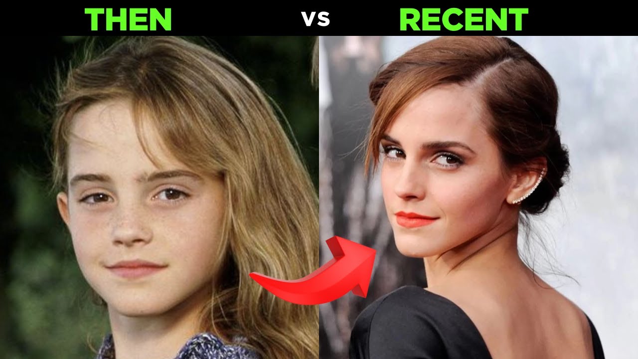You Won’t Believe These 12 Celebrities' Before & After | Top 12 Female ...