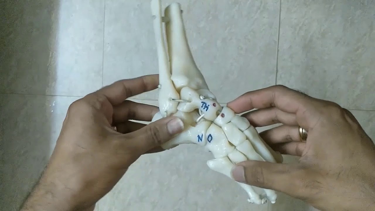 CLUBFOOT/CTEV - getting straight with the basics - YouTube