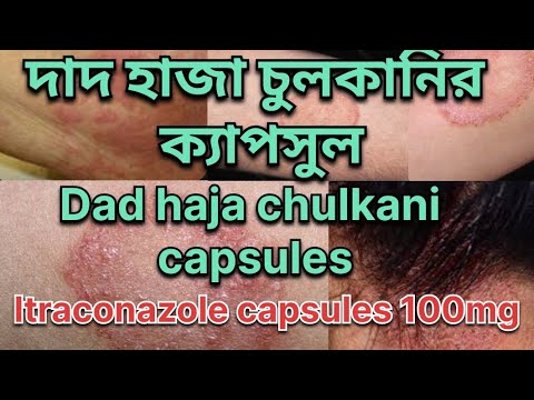 Dad haja chulkani capsul. Itraconazole capsules 100 mg. দাদ হাজা ...