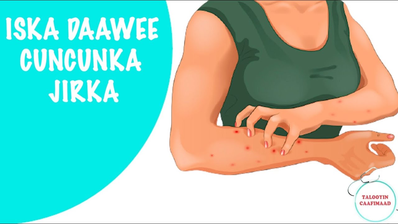 ISKA DAAWEE CUNCUNKA JIRKA AMA MAQAARKA. Dr farad - YouTube