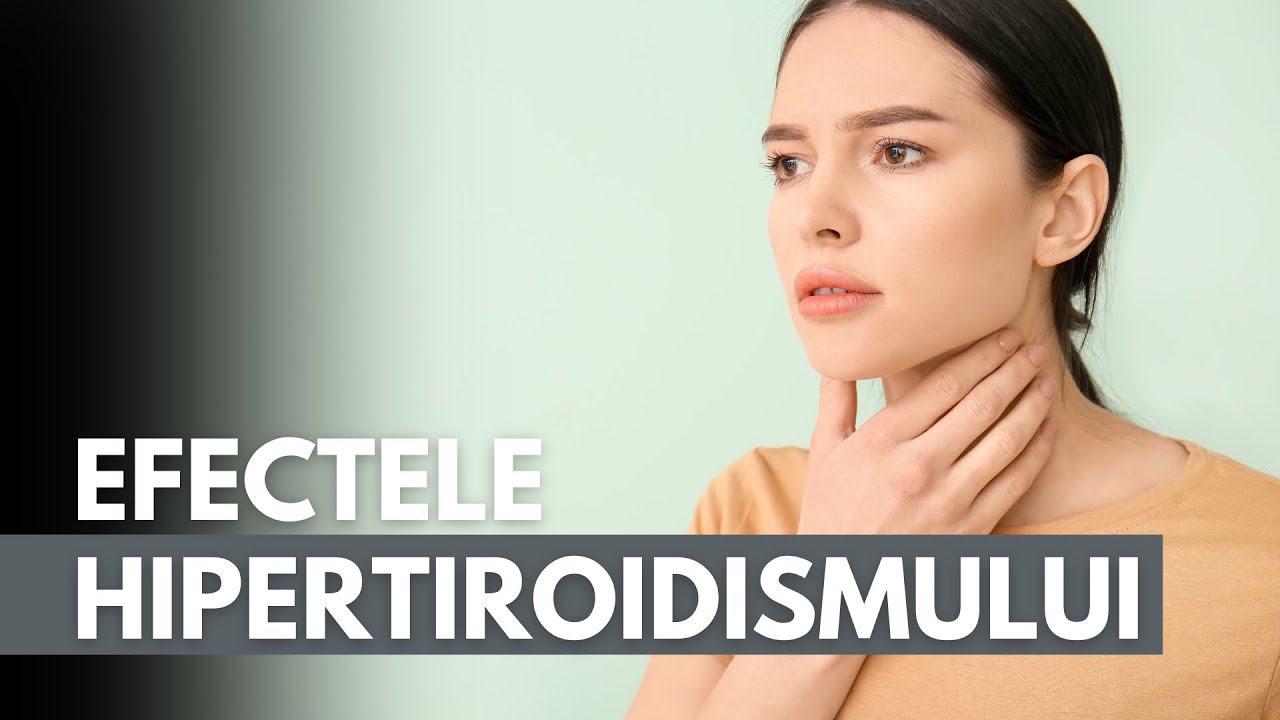 Hipertiroidismul: Efecte și simptome, cu Dr. Monalisa Preda-Ivașcu ...