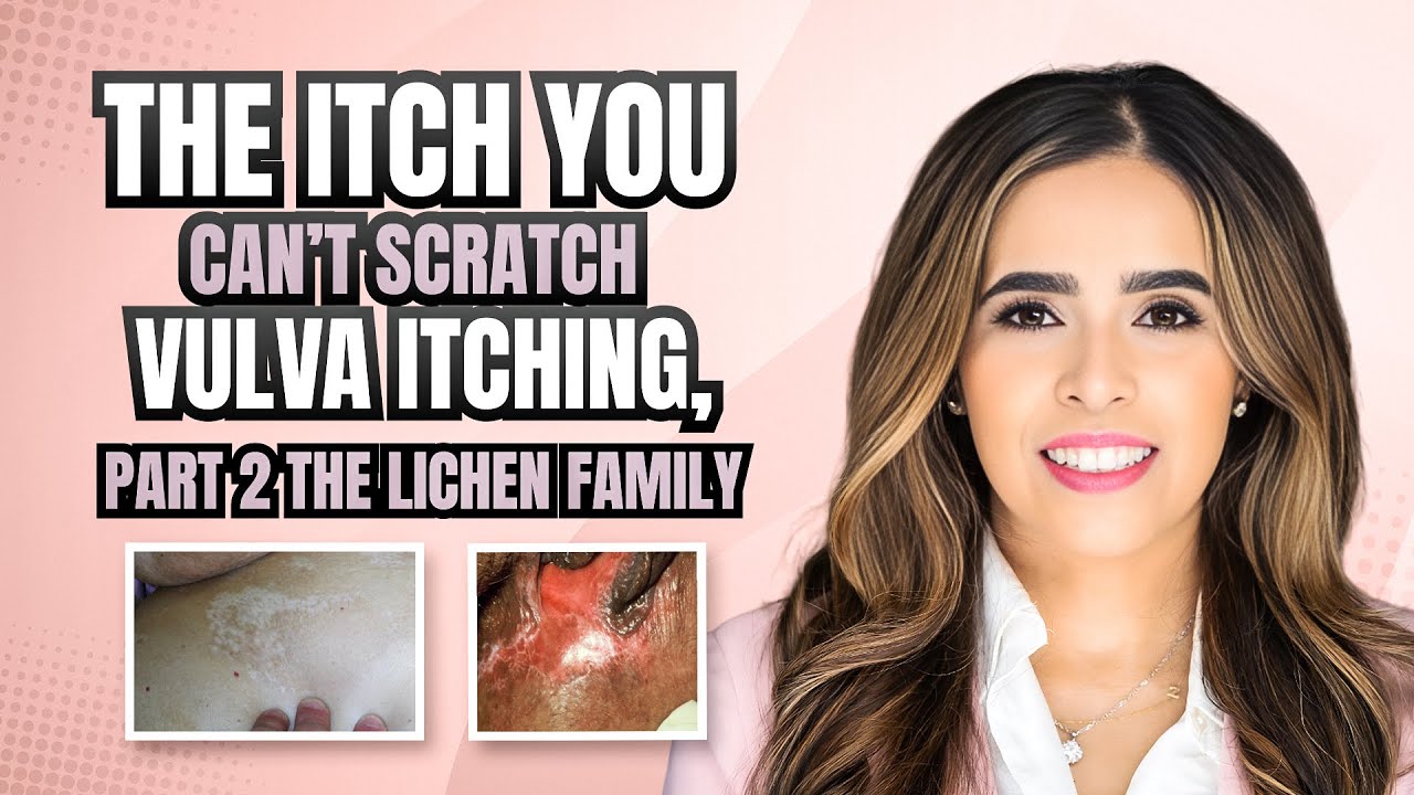 The Itch You Can't Scratch Vulvar Itching Part 2: The Lichen Family ...