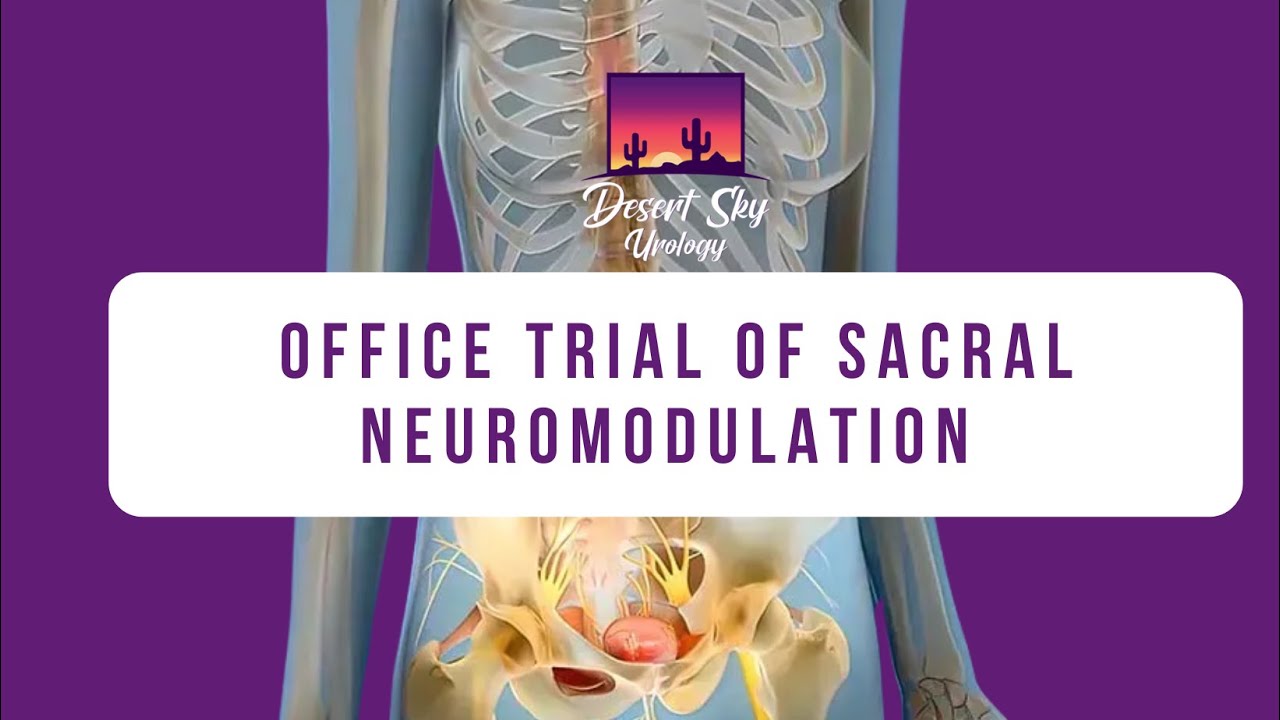 Office Trial of Sacral Neuromodulation | Overactive Bladder & Urinary ...
