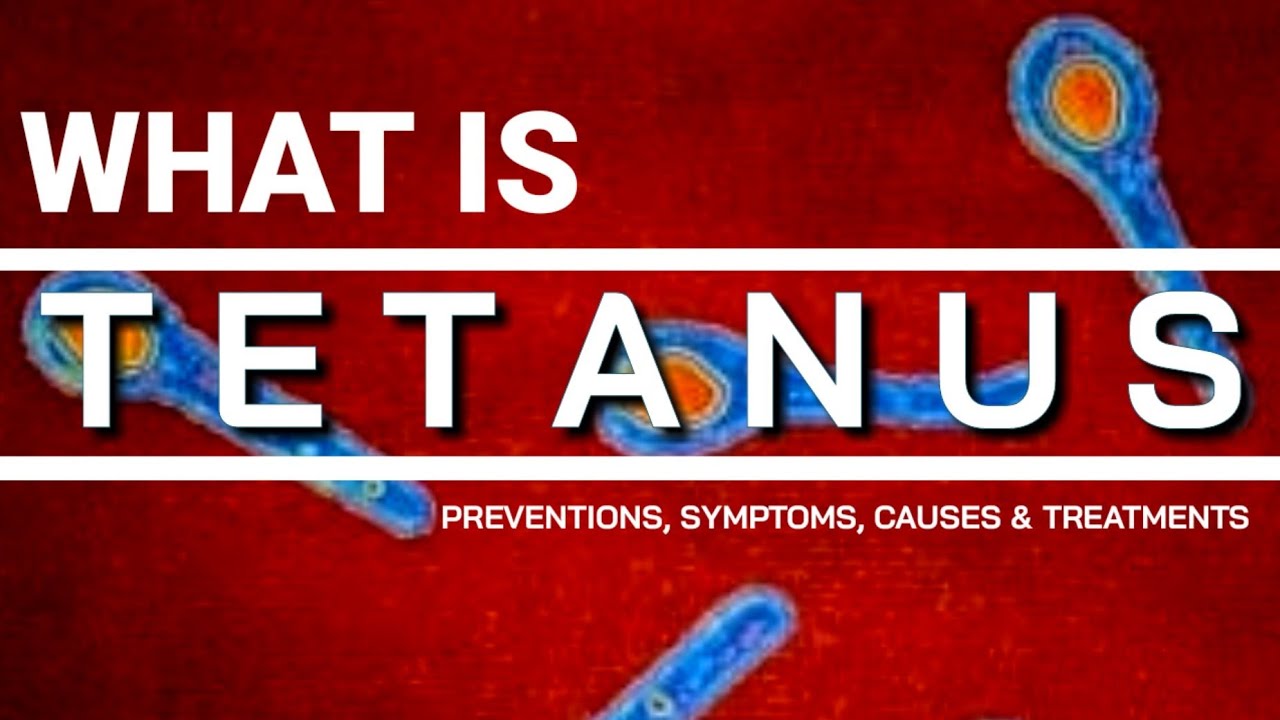 What is Tetanus? Preventions, Symptoms, causes and treatments | PH RED ...