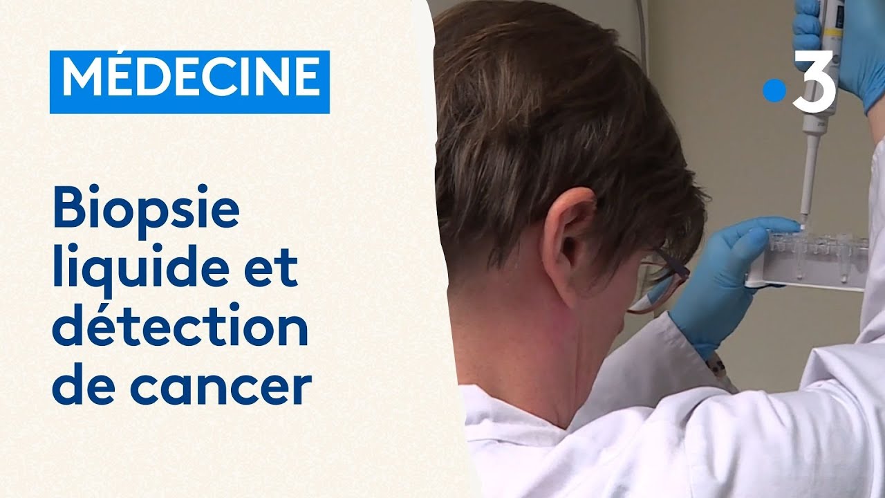 Médecine : biopsie liquide et détection de cancer, une révolution ...