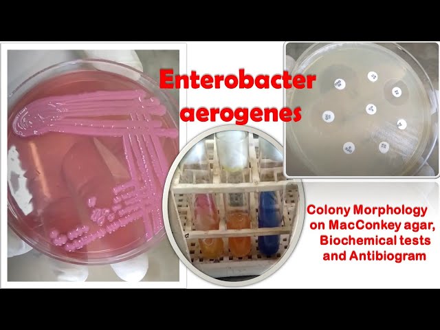 Enterobacter Aerogenes Tsi Agar ID Help : R/microbiology