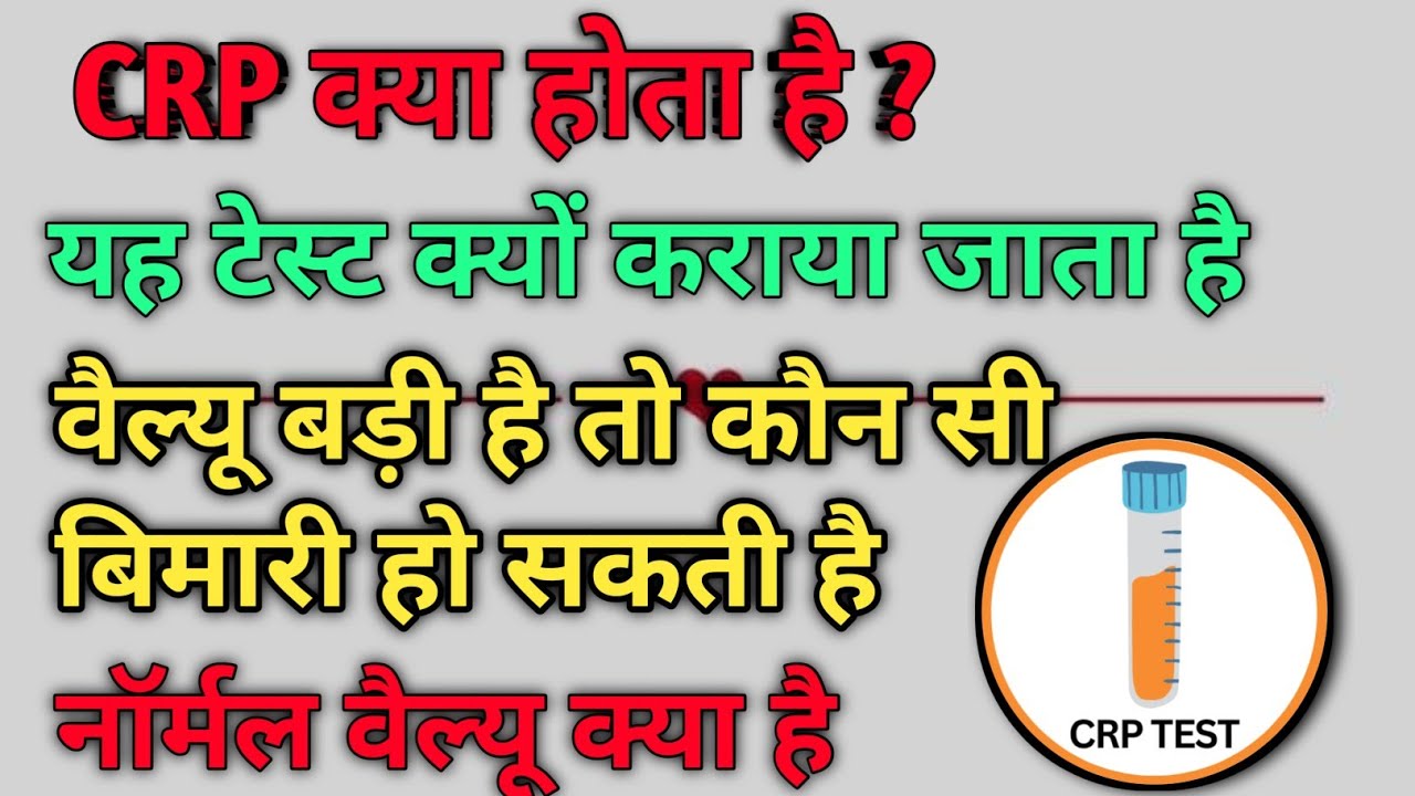 CRP Blood Test CRP Blood Test Normal Range CRP Test Procedure CRP crp-blood-test-crp-blood-test-normal-range-crp-test-procedure-crp