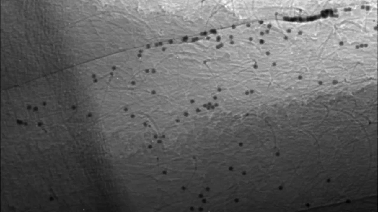 Live-pig-airway surface imaging and whole-pig CT - YouTube