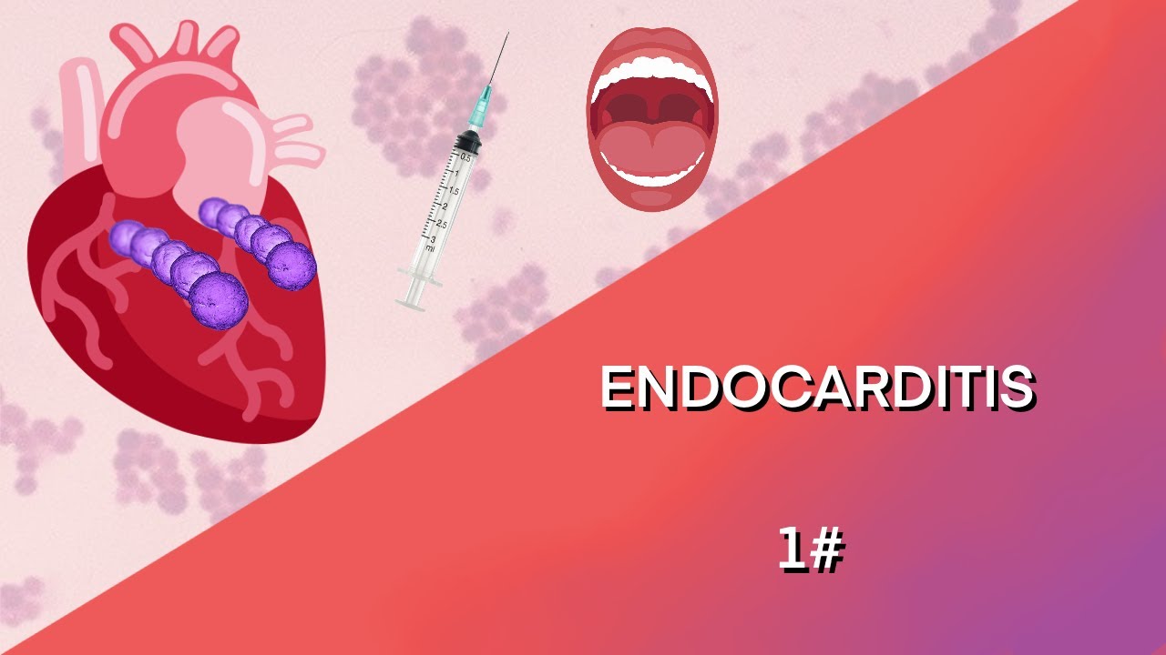 ENDOCARDITIS INFECCIOSA - parte 1#: FISIOPATOLOGIA, FACTORES DE RIESGO ...