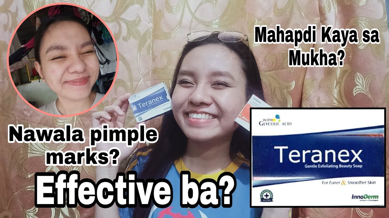 LOOKING FOR A SOAP NA PAN-TANGGAL NG MGA PIMPLE MARKS/BLEMISHES? TRY ...