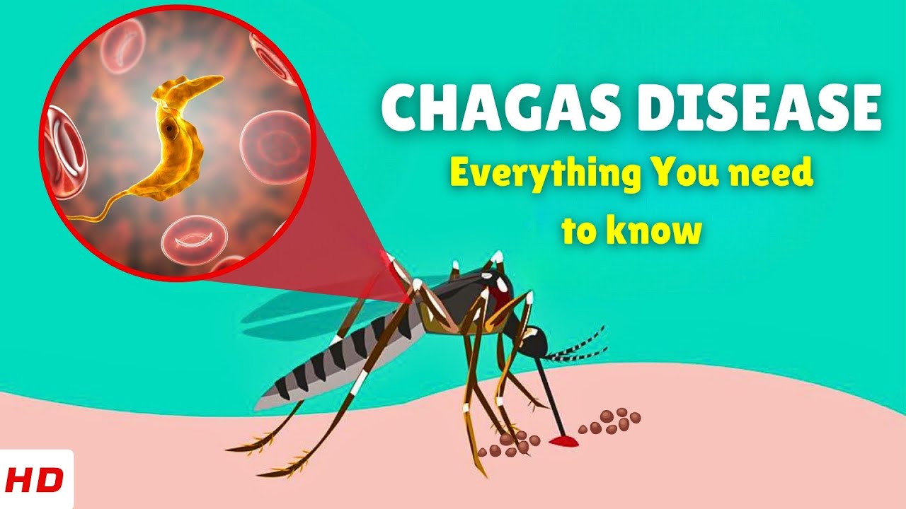Chagas Disease – Causes, Signs and Symptoms, Diagnosis & Treatment ...