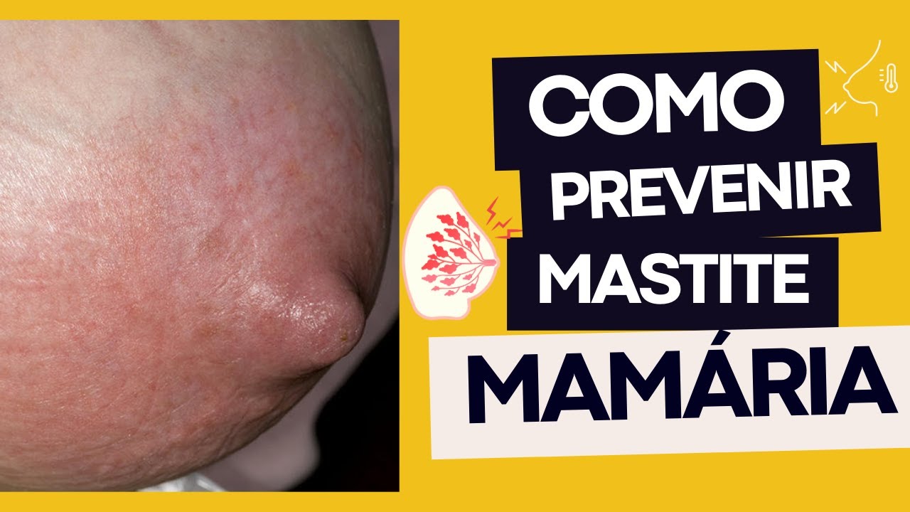Mastite na amamentação: Como prevenir. Alda Figueredo #amamentar # ...
