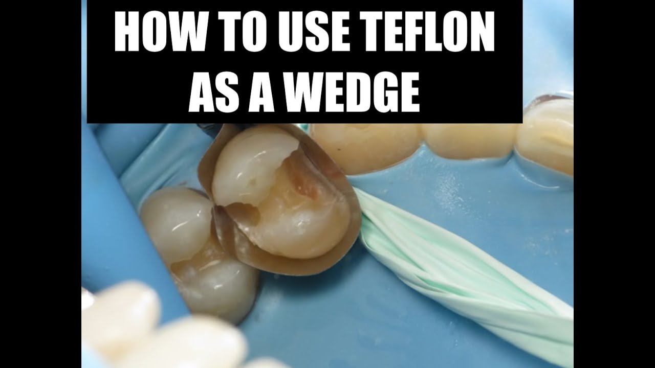 How to use Teflon as a Wedge - YouTube