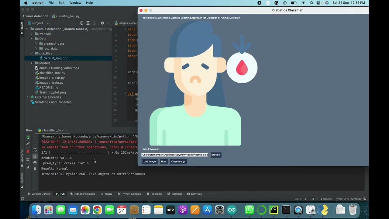 Anemia detection using machine learning book now - YouTube