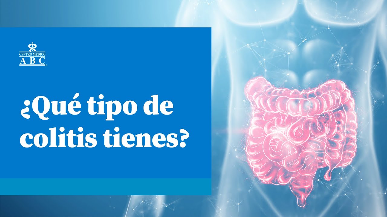 ¿Qué tipo de colitis tienes? - YouTube