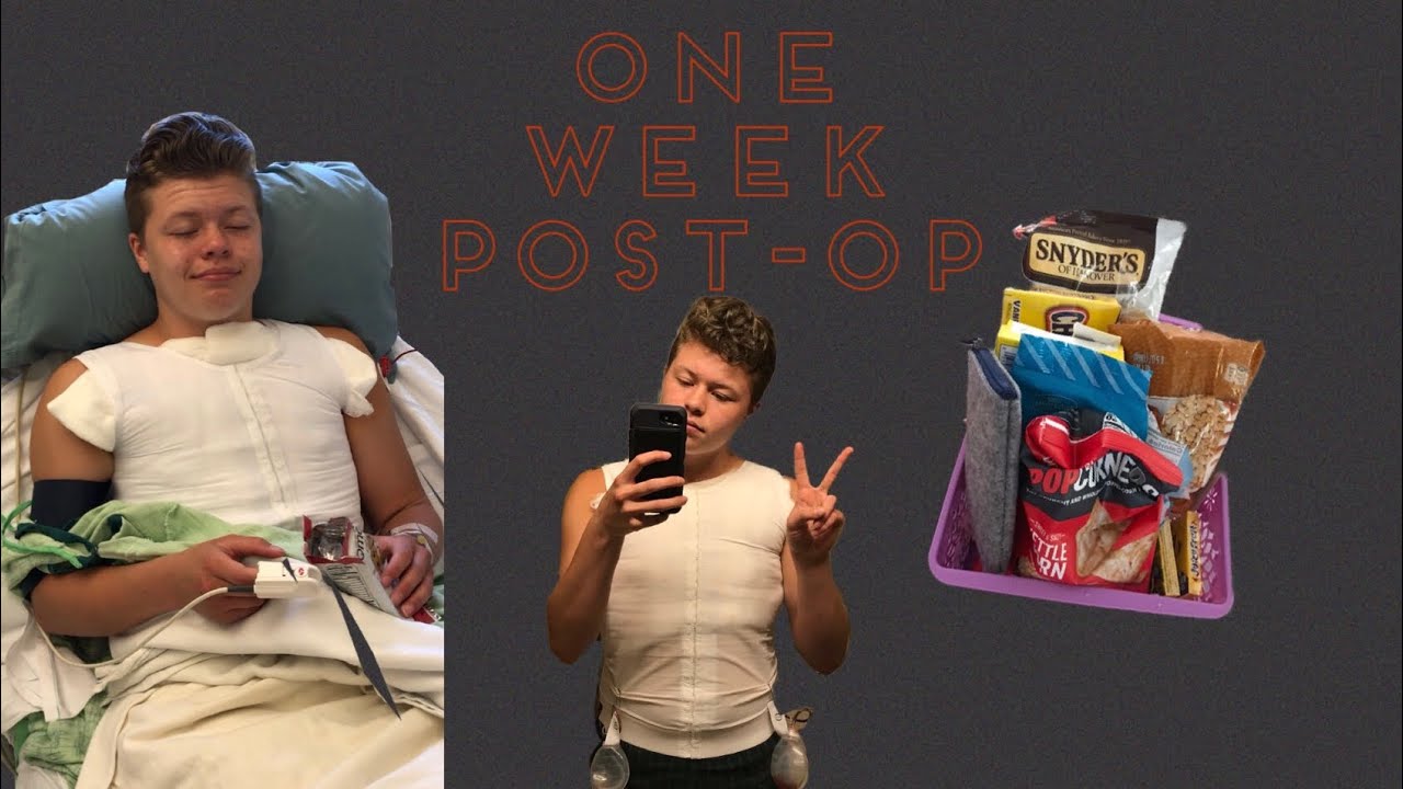 TOP SURGERY - One Week Post-Op - YouTube