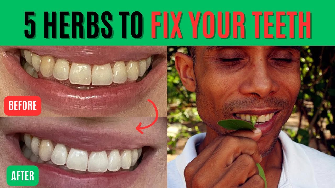 5 Science Backed Herbs To Fix Your Teeth / Whiten & Remineralize Teeth ...