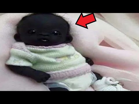 Herkes bu bebeği terk etti. Bugün başına gelenlerin bu olduğuna inanamayacaksın!