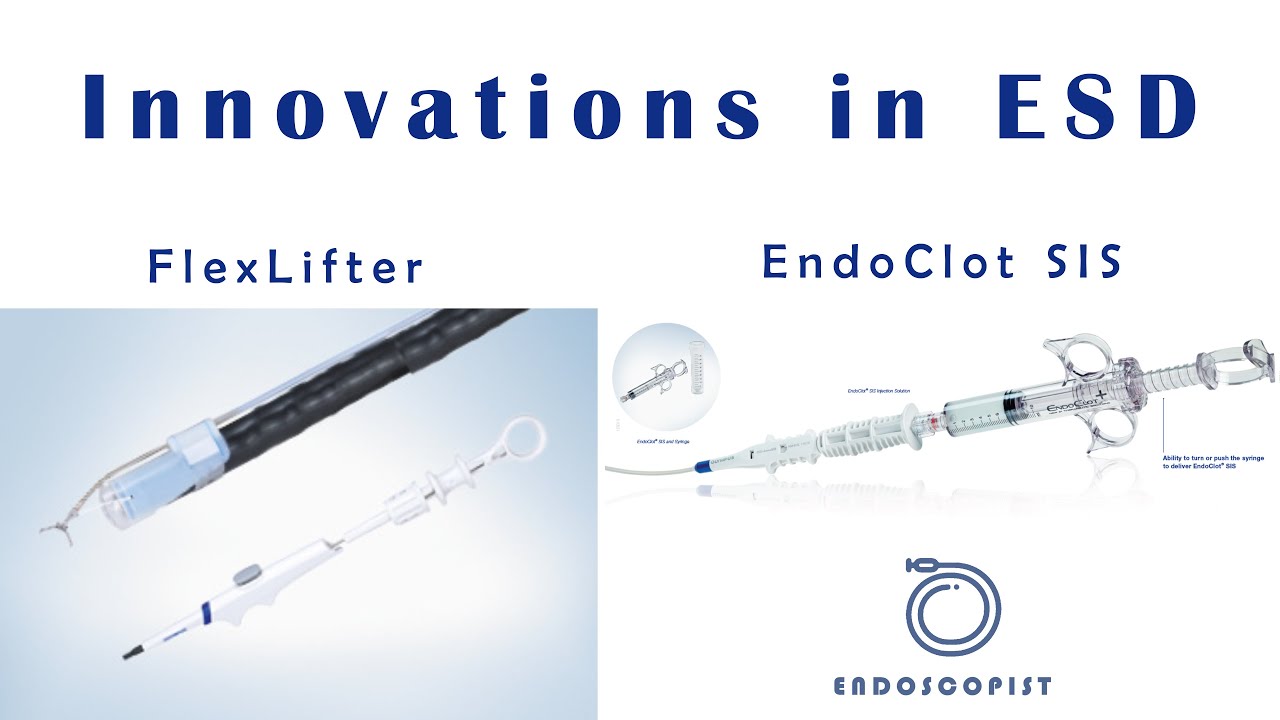 Revolutionizing ESD: Olympus Endoclot & Flexlifter in Action - YouTube