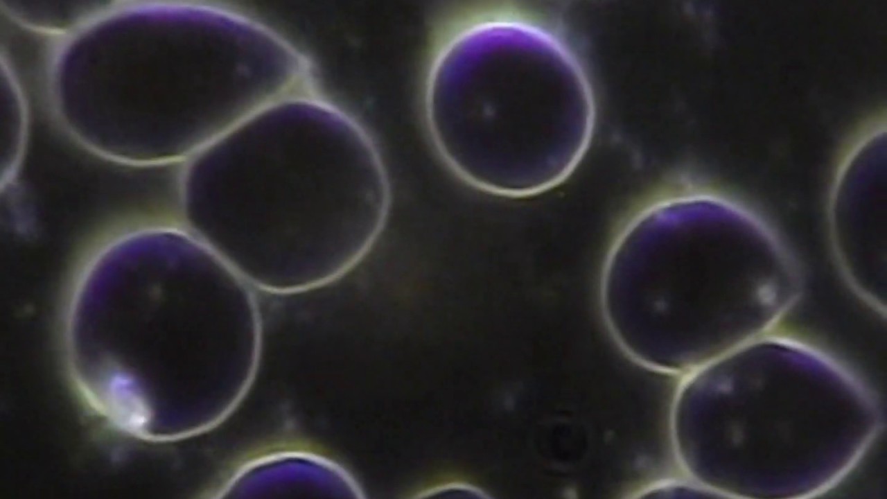 LIVE BLOOD CELL ANALYSIS: HAPPY RED BLOOD CELLS (RBC'S) - YouTube