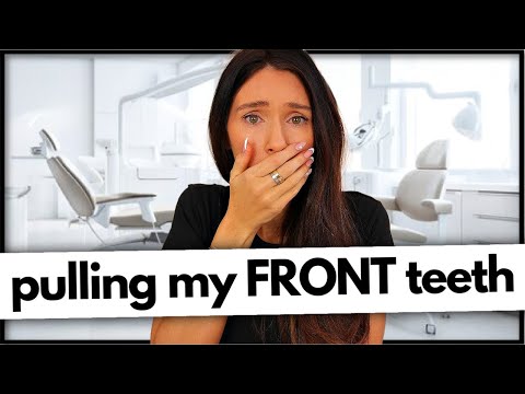 I had my FRONT TEETH pulled…and I can’t talk.
