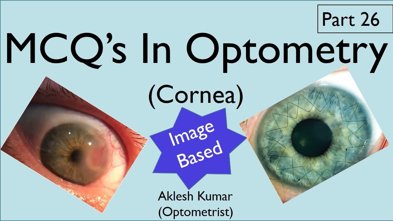 MCQ’s in Optometry | Cornea | Diseases of Cornea | Part 26 - YouTube