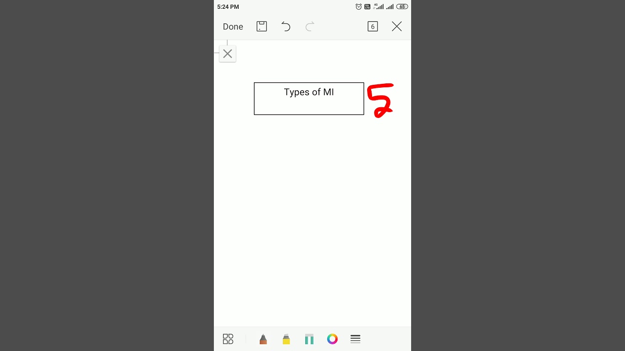 Types of MI - YouTube
