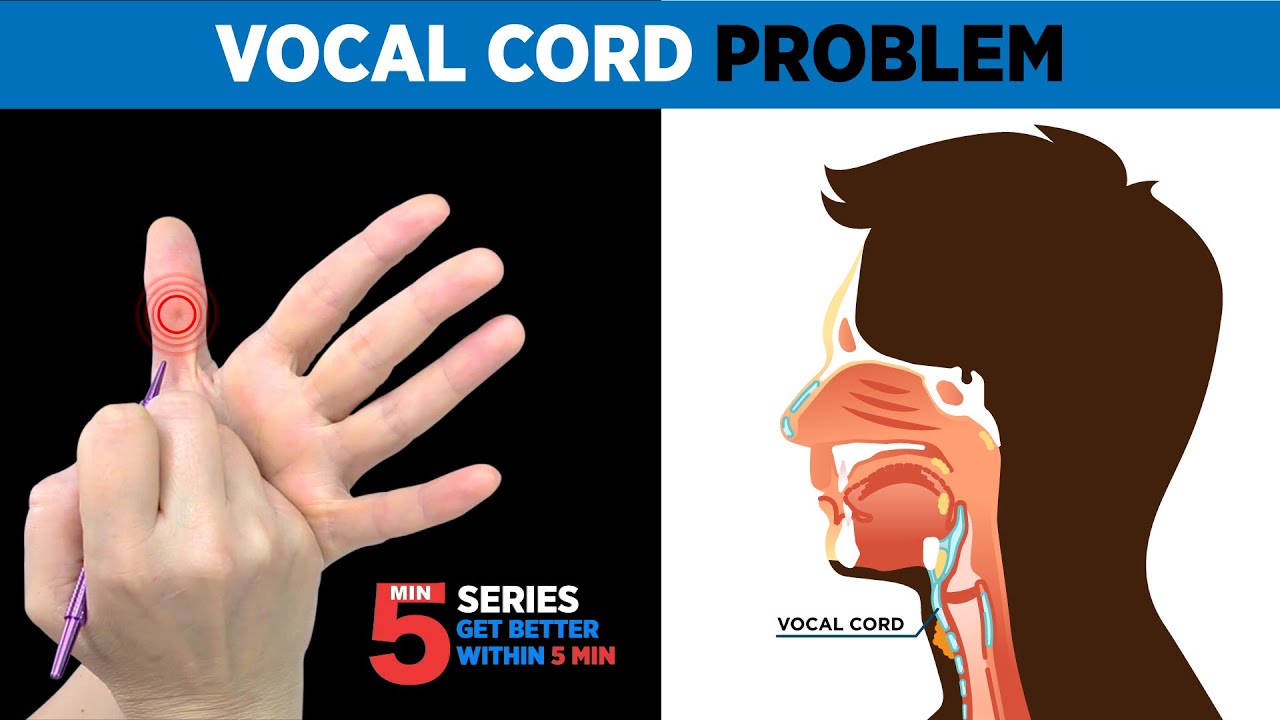 SUJOK TREATMENT FOR Vocal Cord Problem😫🔥(ON LEFT HAND) - YouTube