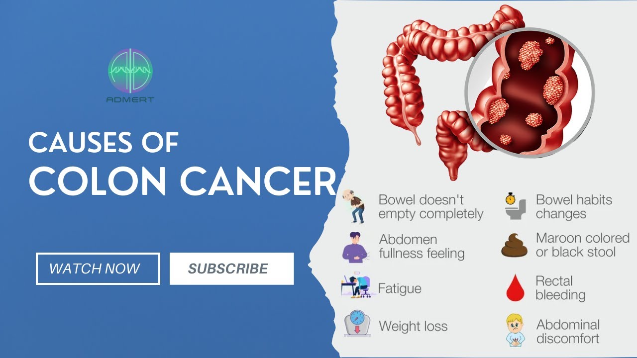 What are the main causes of Colon Cancer? | Dr.Ravindran Kumeran ...
