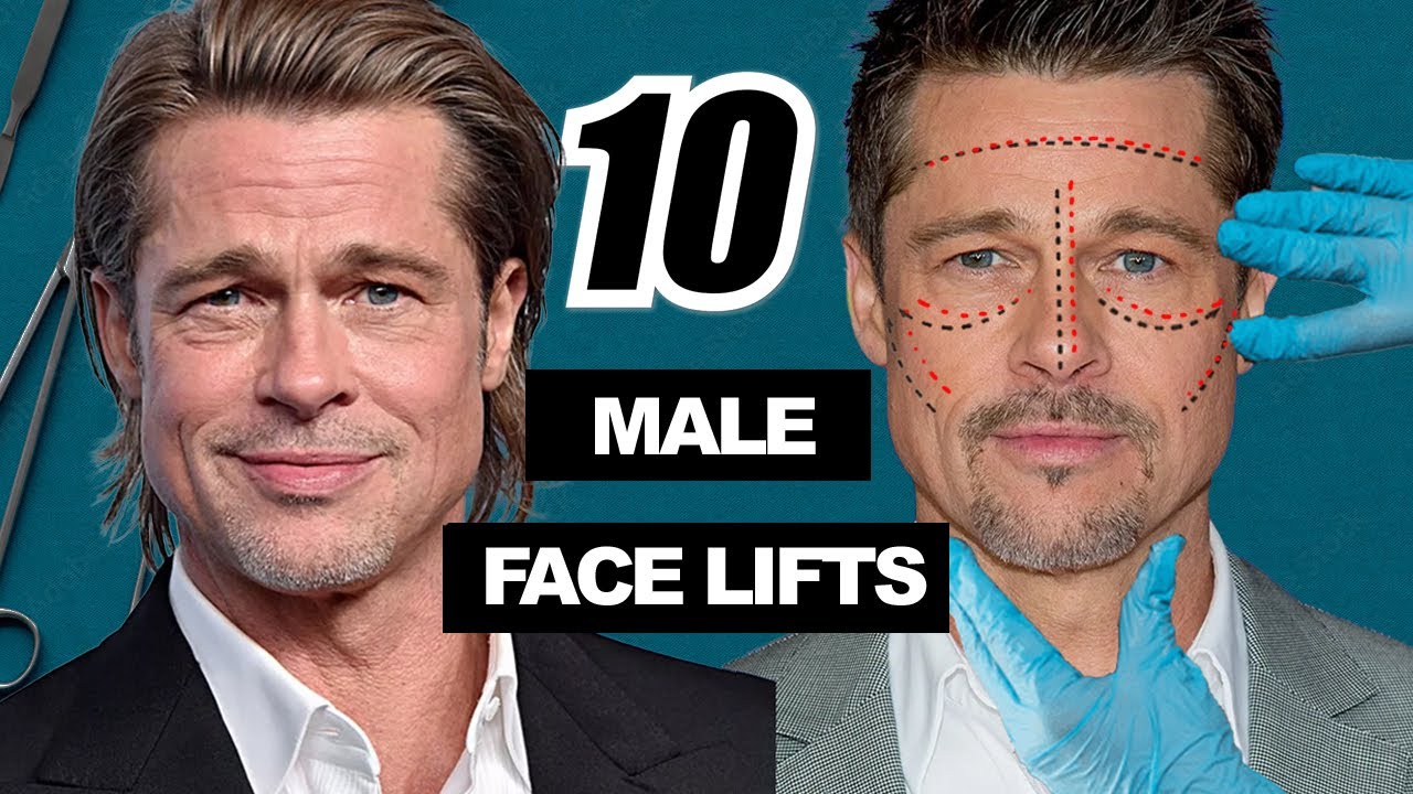 Male Celebrities You Didn't Know Had FACELIFTS | Brad Pitt, Bradley ...