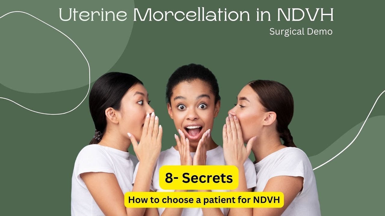 8 Secrets of NDVH | How to choose a patient | Uterine morcellation in ...