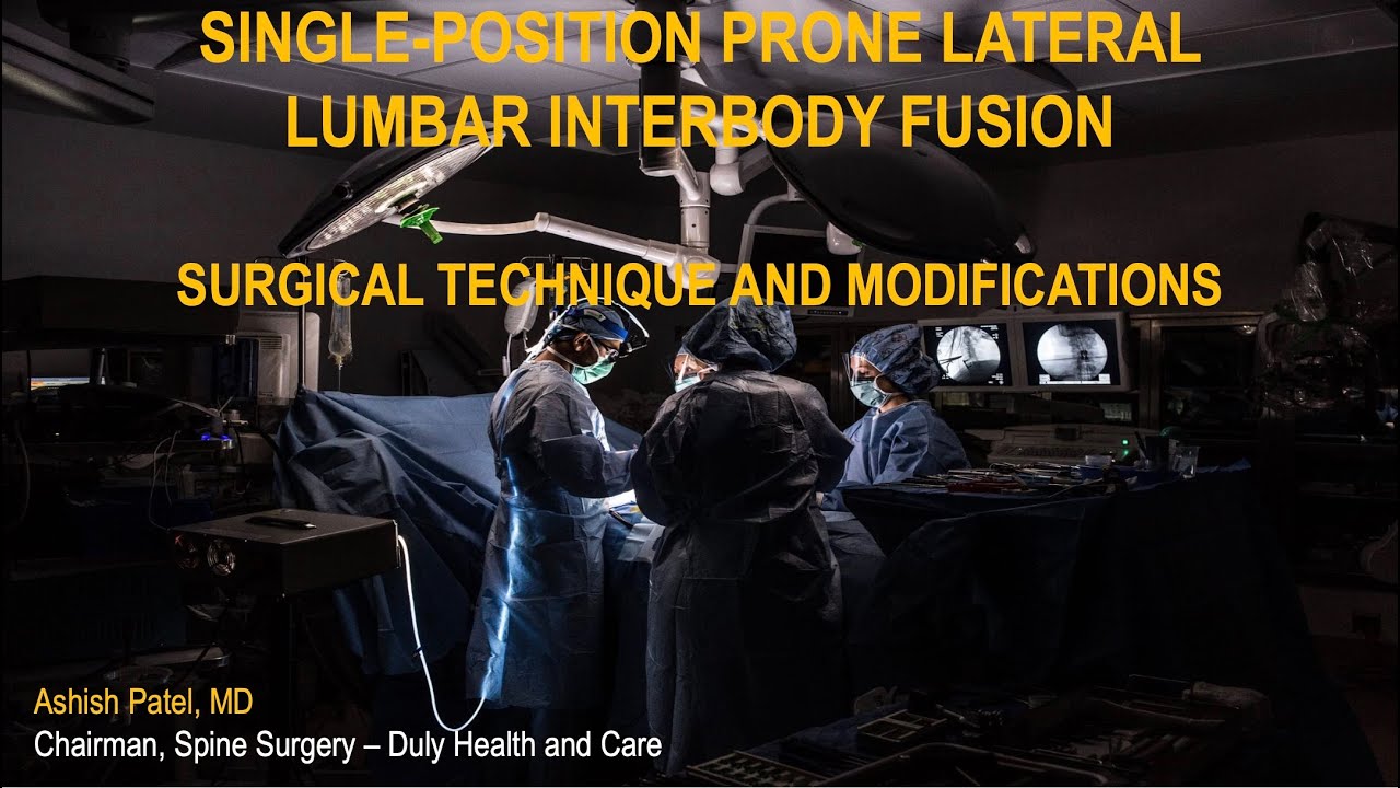 Single-Position Prone Lateral Lumbar Interbody Fusion Surgical ...