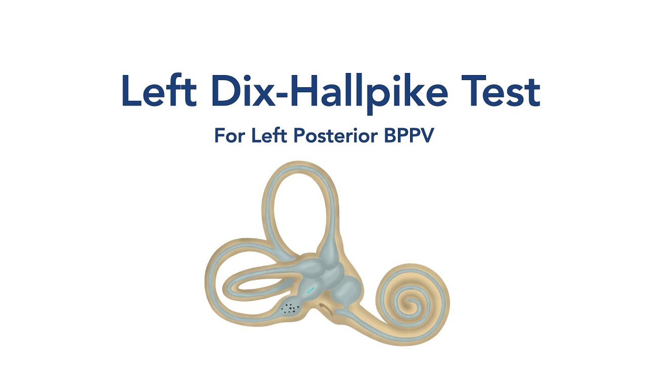 At Home Left Dix-Hallpike Test for BPPV Vertigo - YouTube