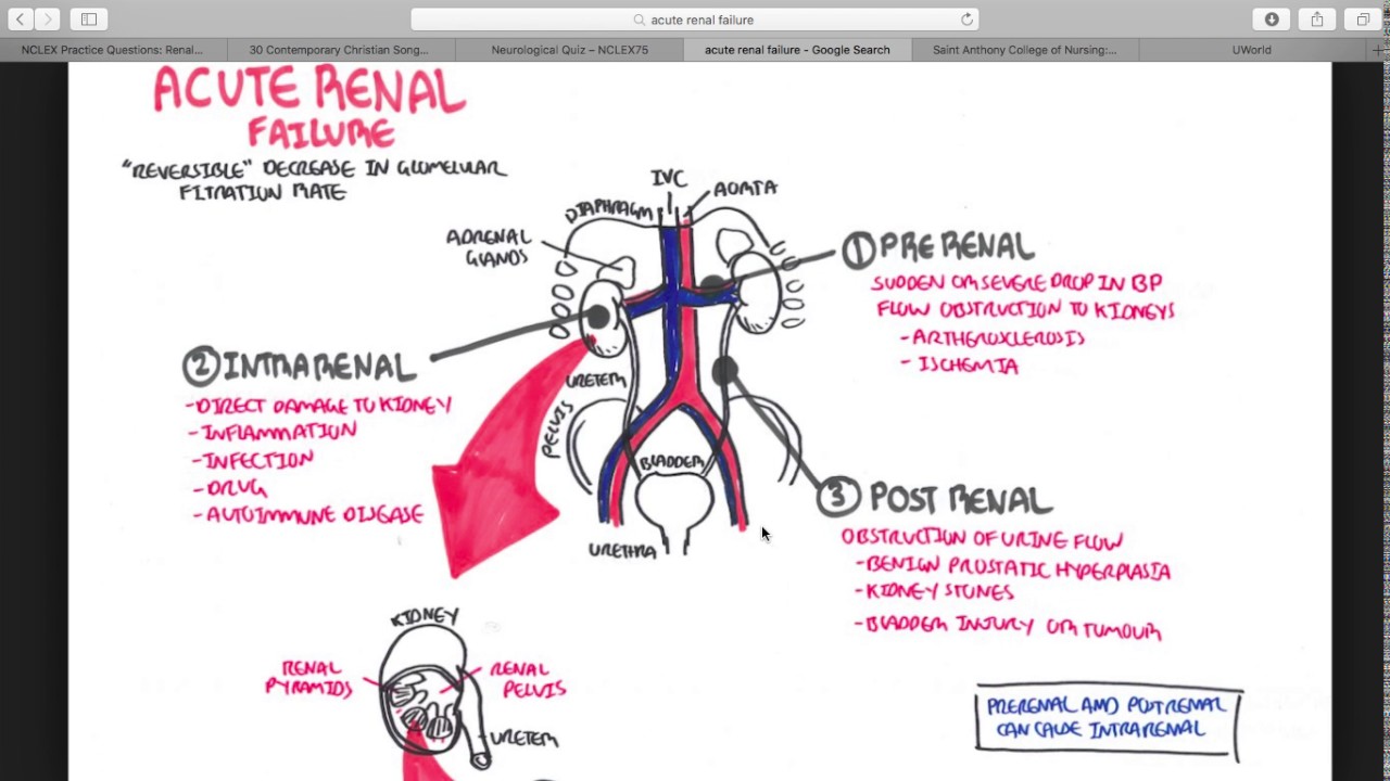 Acute Kidney Injury - YouTube