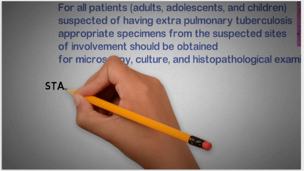 DOTS In Treatment Of TB YouTube dots-in-treatment-of-tb-youtube