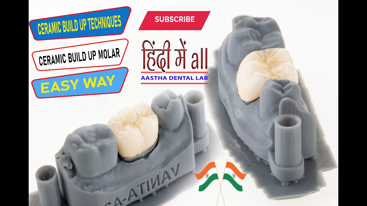 Step-by-Step Guide: Build up Ceramic Lower Six Molars for Perfect Fit ...