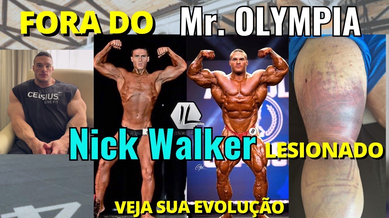 LESÃO NA POSTERIOR TIRA NICK WALKER DO MR. OLYMPIA 2023 - YouTube
