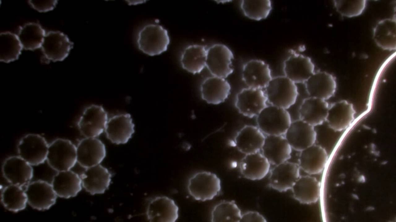 Lyme Spirochetes in RBC - After Doxycycline 21 days - YouTube