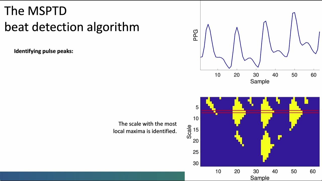 MSPTDfast: An Efficient Photoplethysmography Beat Detection Algorithm - YouTube