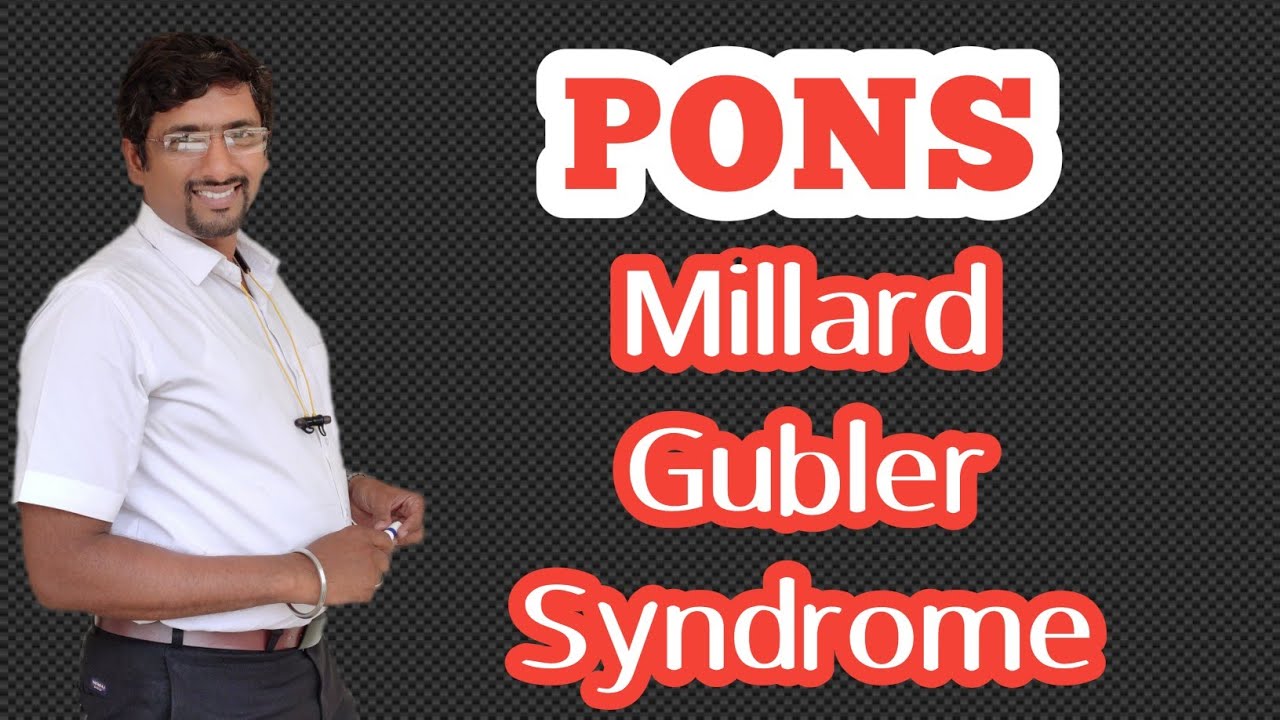 PONS ( part -5) applied anatomy. Millard Gubler syndrome - YouTube