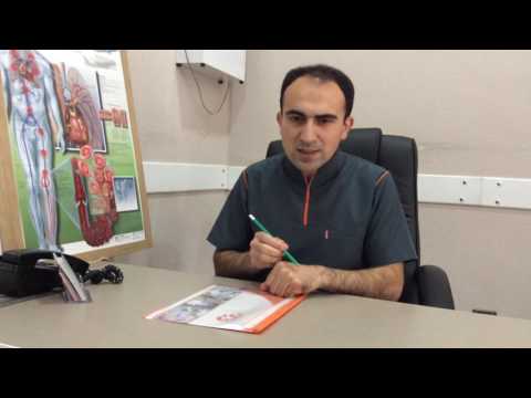 Varikozun tebii yolla mualicesi Varikozun evde mualicesi Varikoz corabi Varikoz kremi Doktor Ismayil