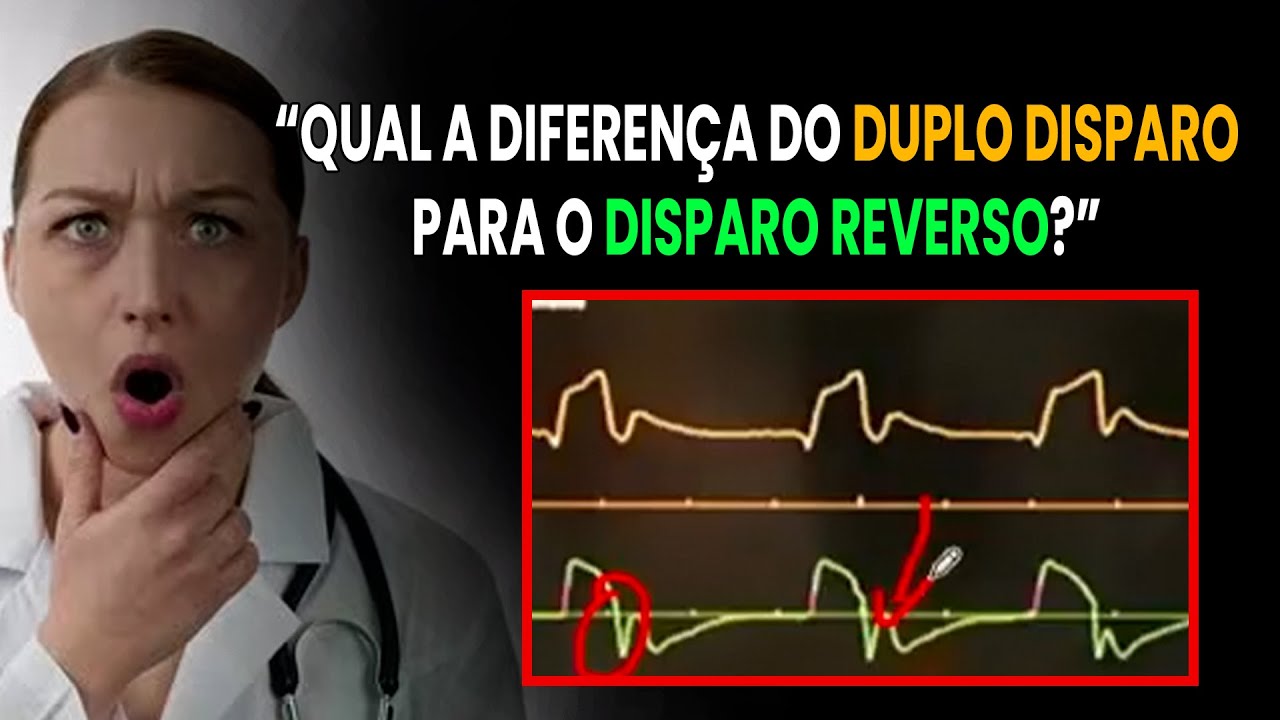 FISIOTERAPEUTA VOCÊ SABE DIFERENCIAR O DUPLO DISPARO DO DISPARO REVERSO ...