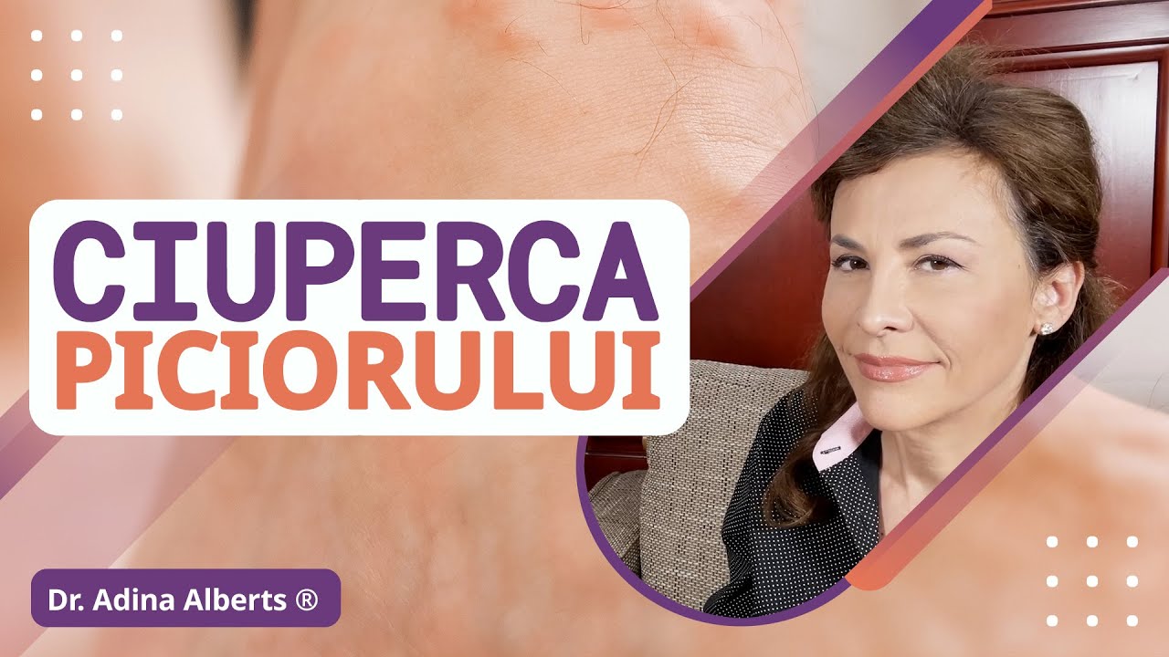 Ciuperca Piciorului - Ciuperca Unghiei - Sfaturi și recomandări simple ...