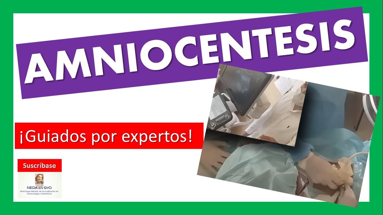 AMNIOCENTESIS. Procedimiento. ¡Guiado por expertos! (PASO A PASO ...