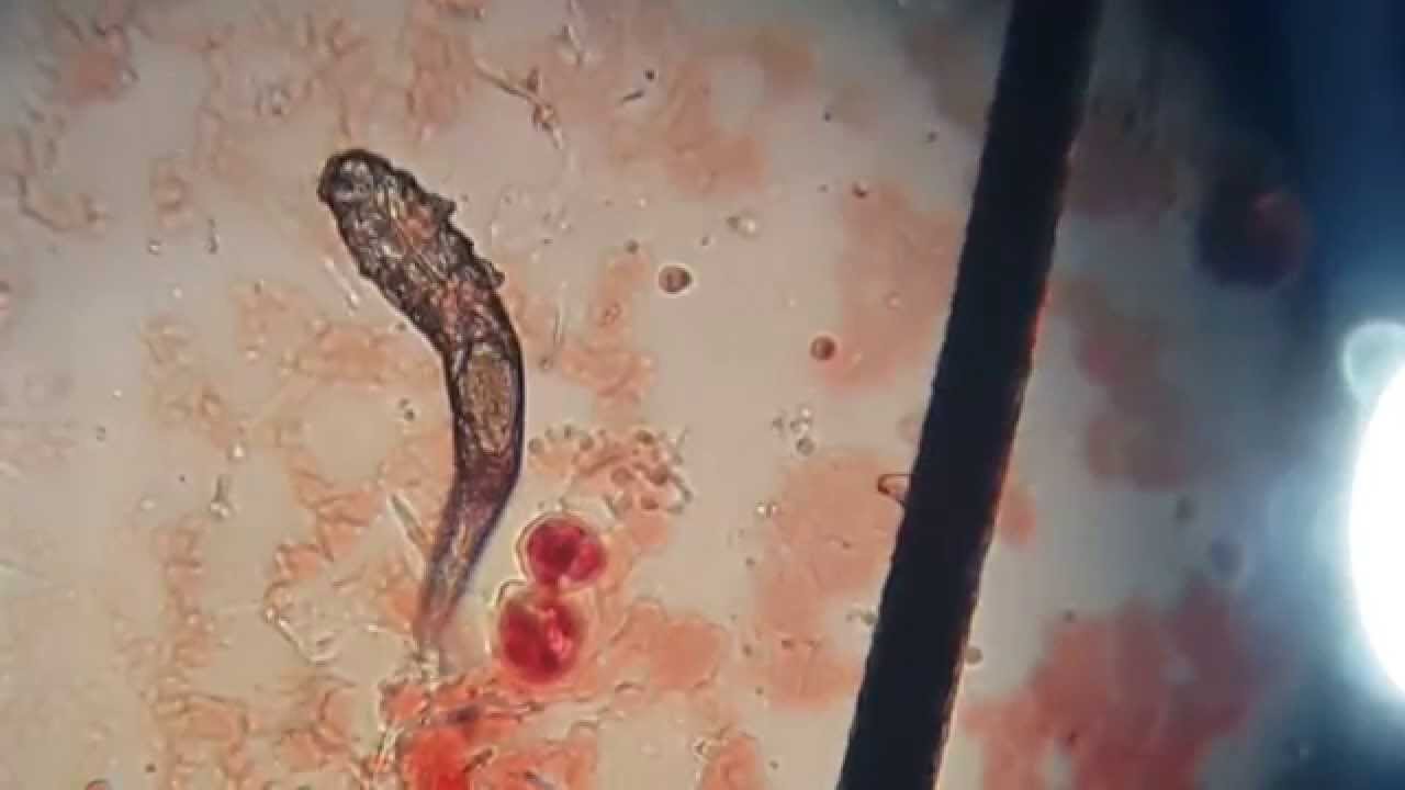 Demodicosis Canina - Demodex Canis - YouTube
