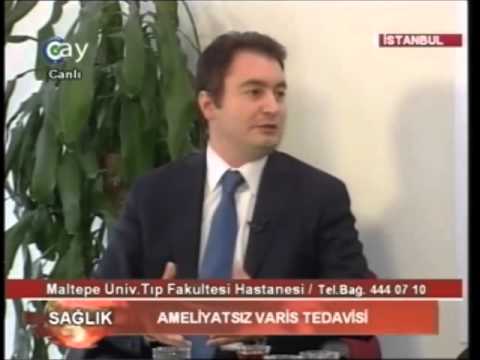 SGK (Emekli Sandığı veya Bağkur) Ameliyatsız varis tedavisi sini karşılıyor mu?