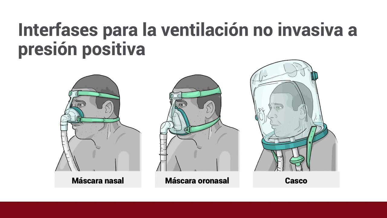 Tratamiento del paciente con disnea moderada - parte 2 - YouTube