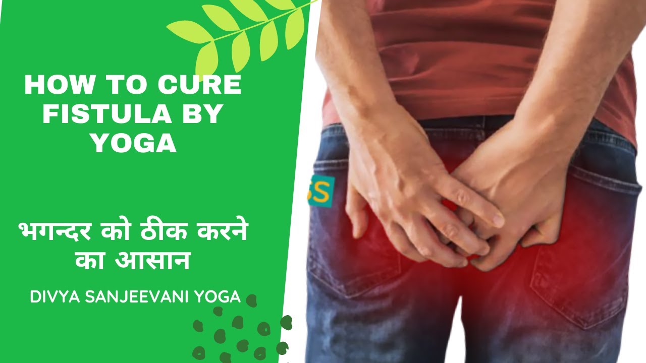 How to cure fistula by yoga|| Best Yoga Treatment For Fistula||भगन्दर ...