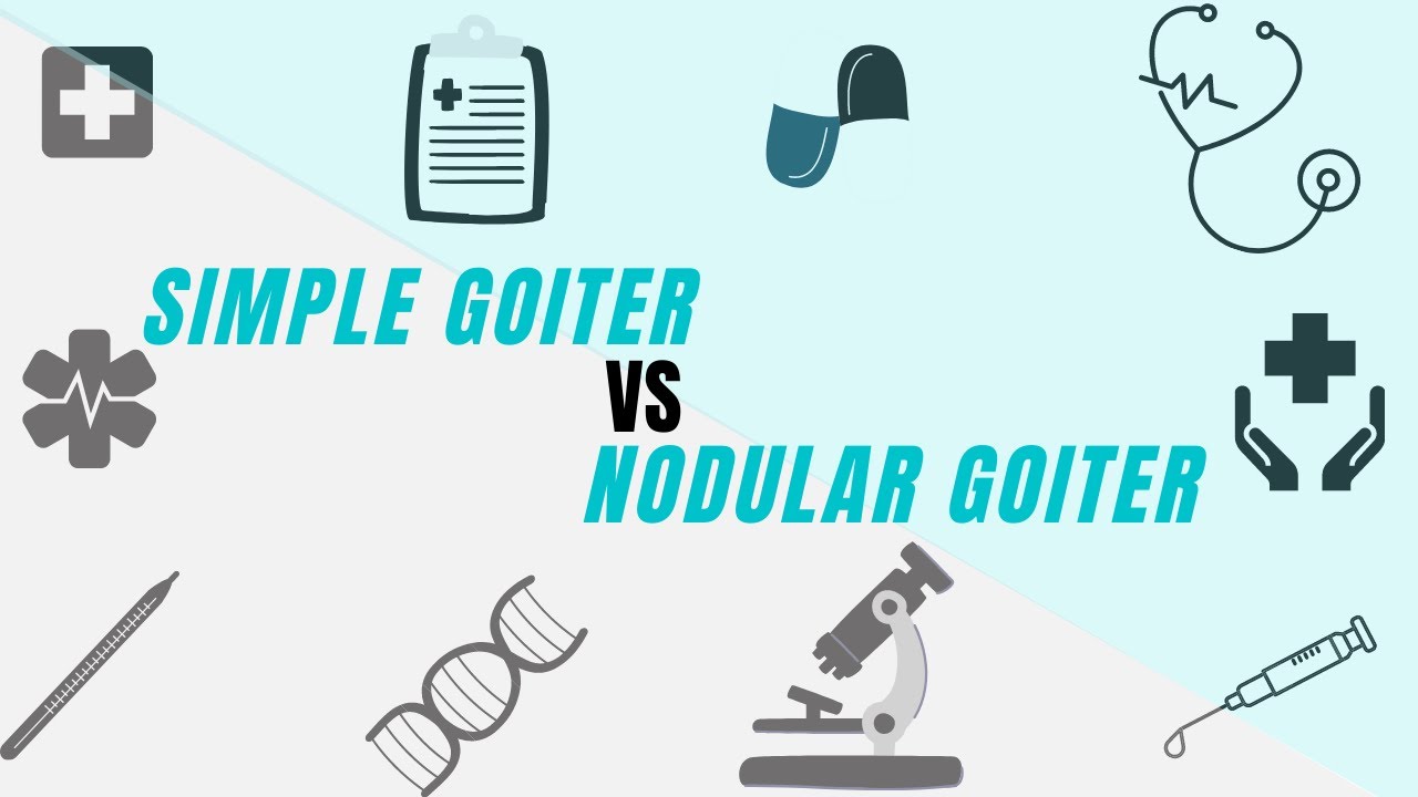 Simple Goiter VS Nodular Goiter - YouTube