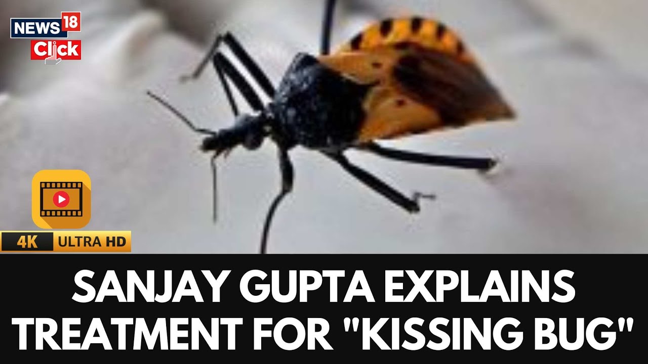Dr. Sanjay Gupta Explains About Chagas Disease | Kissing Bugs, Symptoms & Prevention | N18G ...
